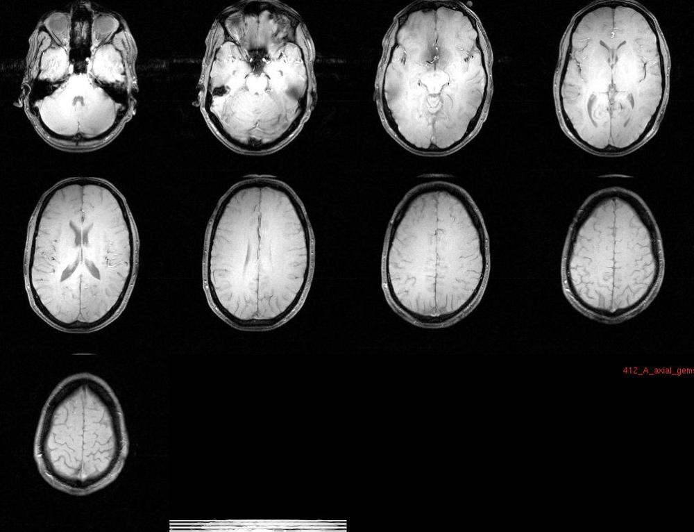 Understanding the Teenage Brain - Generation Next